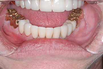 Gallery | Dentist in Scottsdale, AZ